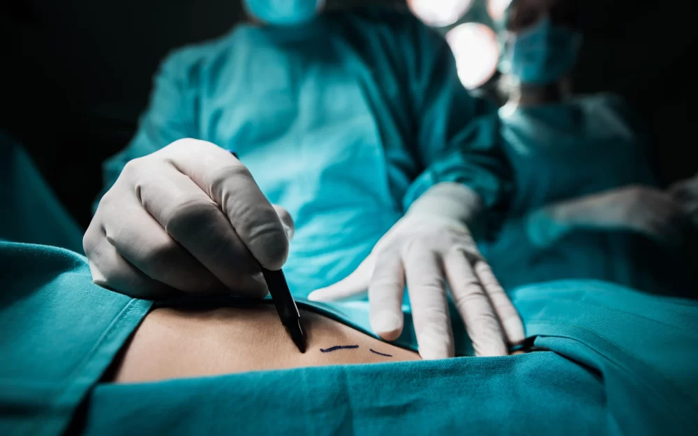 HOW TO TAKE CARE OF SURGICAL WOUND | Dr. Aayush Shrestha